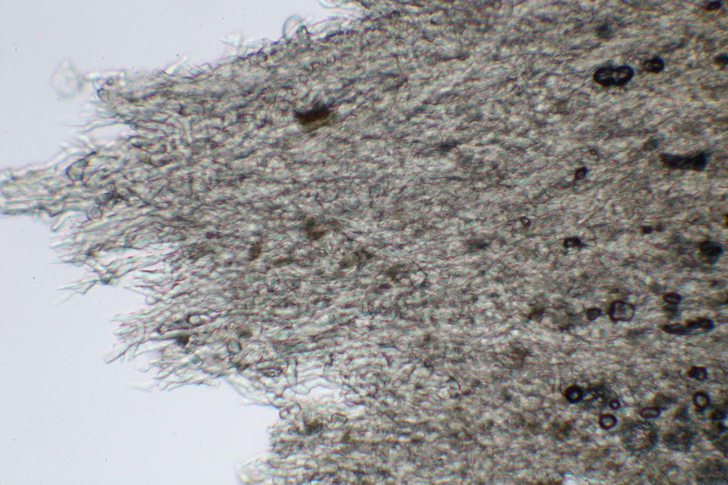 El mundo microscópico de los hongos: Xylaria polymorpha (Pers.) Grev.