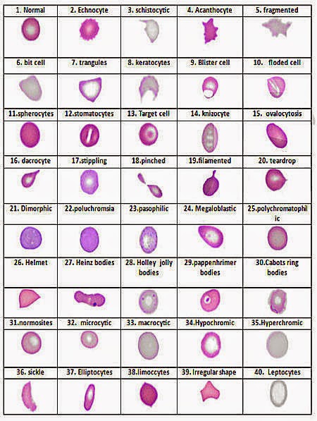 Medical Laboratory and Biomedical Science: Frequency Rate of Abnormal ...