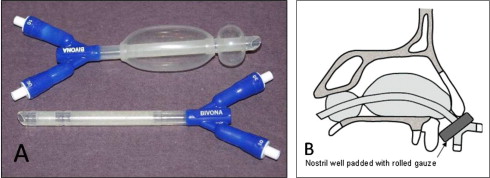 ENT for medical students: NOSE - Epistaxis