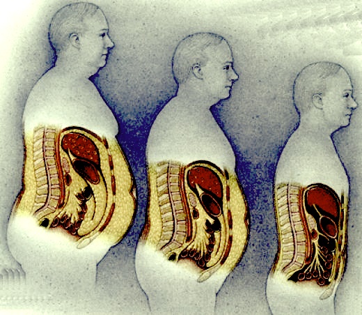 The Arts, Sciences and Medicine: Obesity. The Scourge of Modern Society