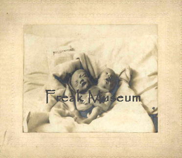 Freak Museum A Private Collection: Freak Photos 19th c.