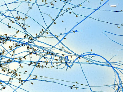 Fun With Microbiology (What's Buggin' You?): Stemphylium species