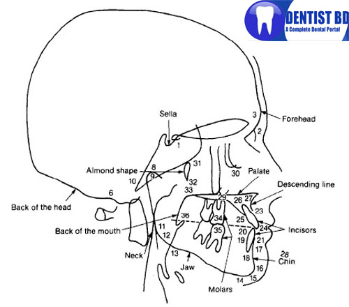 HU TU TU: Cephalogram