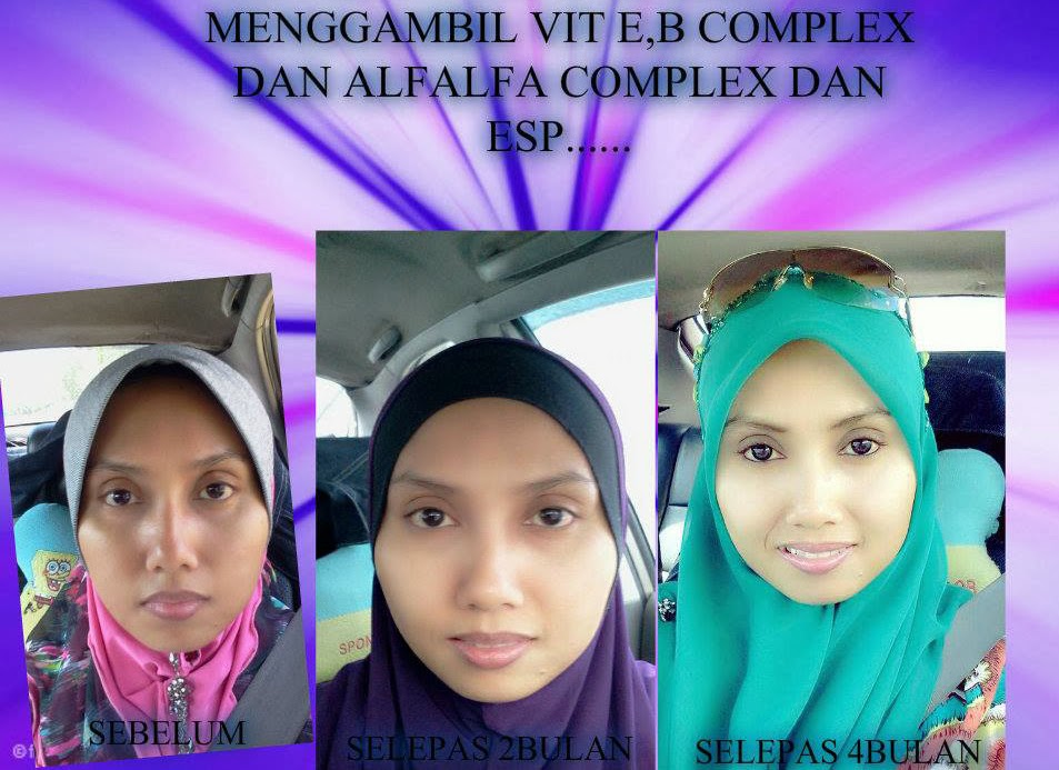 Rahsia Kulit Putih Gebu Tanpa Perlu Bermekap | Beli Vitamin Shaklee