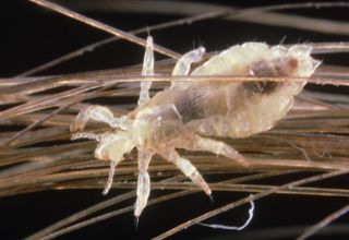 Pédiculose - Maladies de Peau