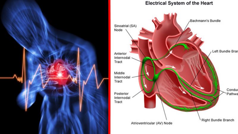 Dr Han Naung @ Henry Han : Electrophysiology and Heart Rhythm : Cardiac ...