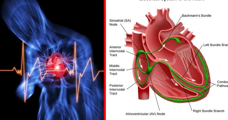 Dr Han Naung @ Henry Han : Electrophysiology and Heart Rhythm : Cardiac ...