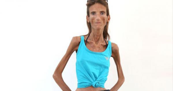 Valera laftin .. Plus mince femme dans le monde ~ ADMCnews