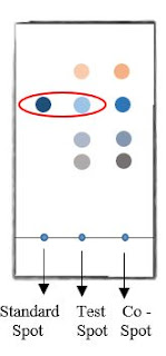 Thin Layer Chromatography (TLC) - Analysis and Evaluation - Pharma ...