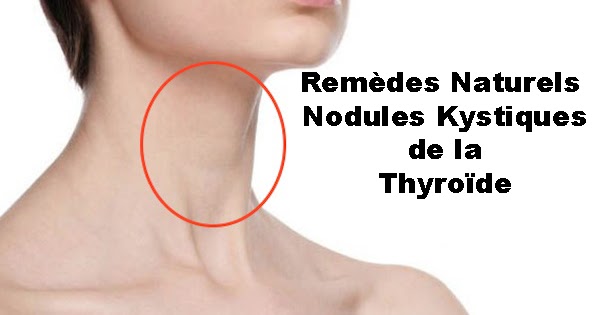 Sports et Santé: Remèdes Naturels pour les Nodules Kystiques de la Thyroïde