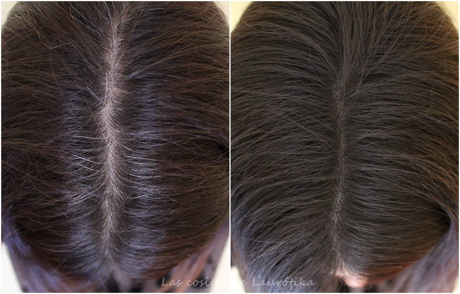 L'Óreal Magic Retouch | Las cositas de Laurótika