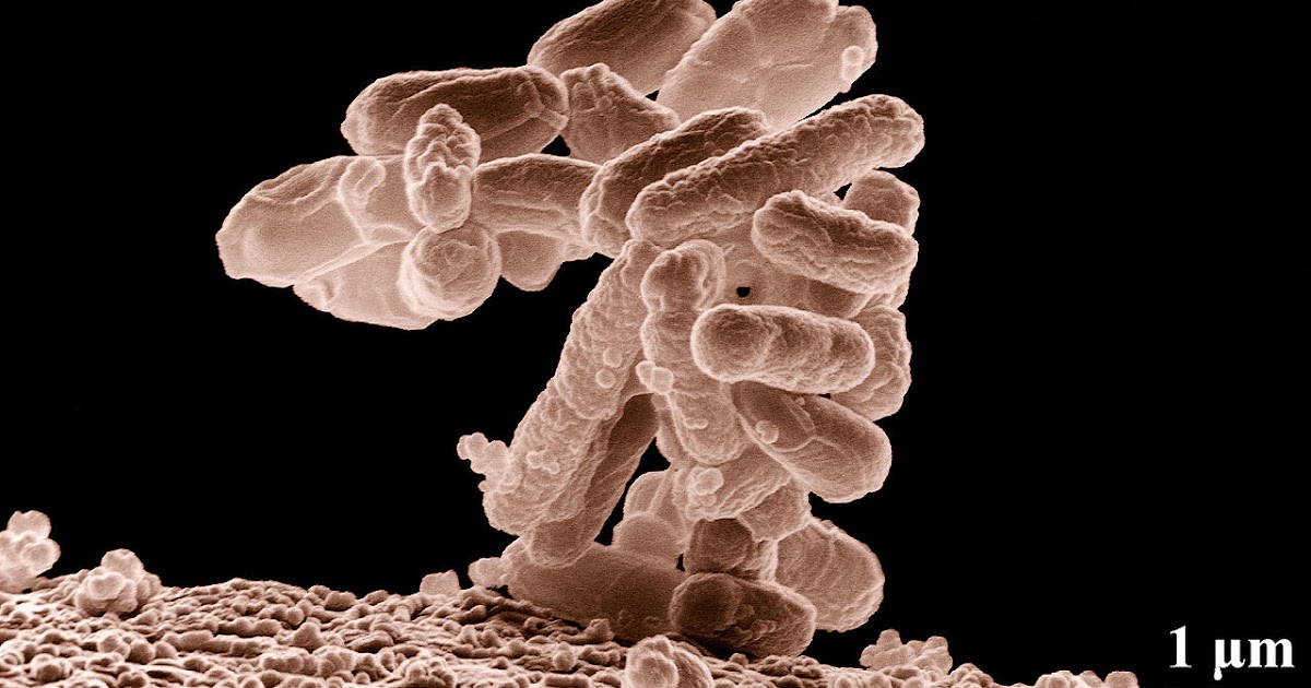 PreClic: ITU por E. Coli-BLEE…¿aislamos o no?