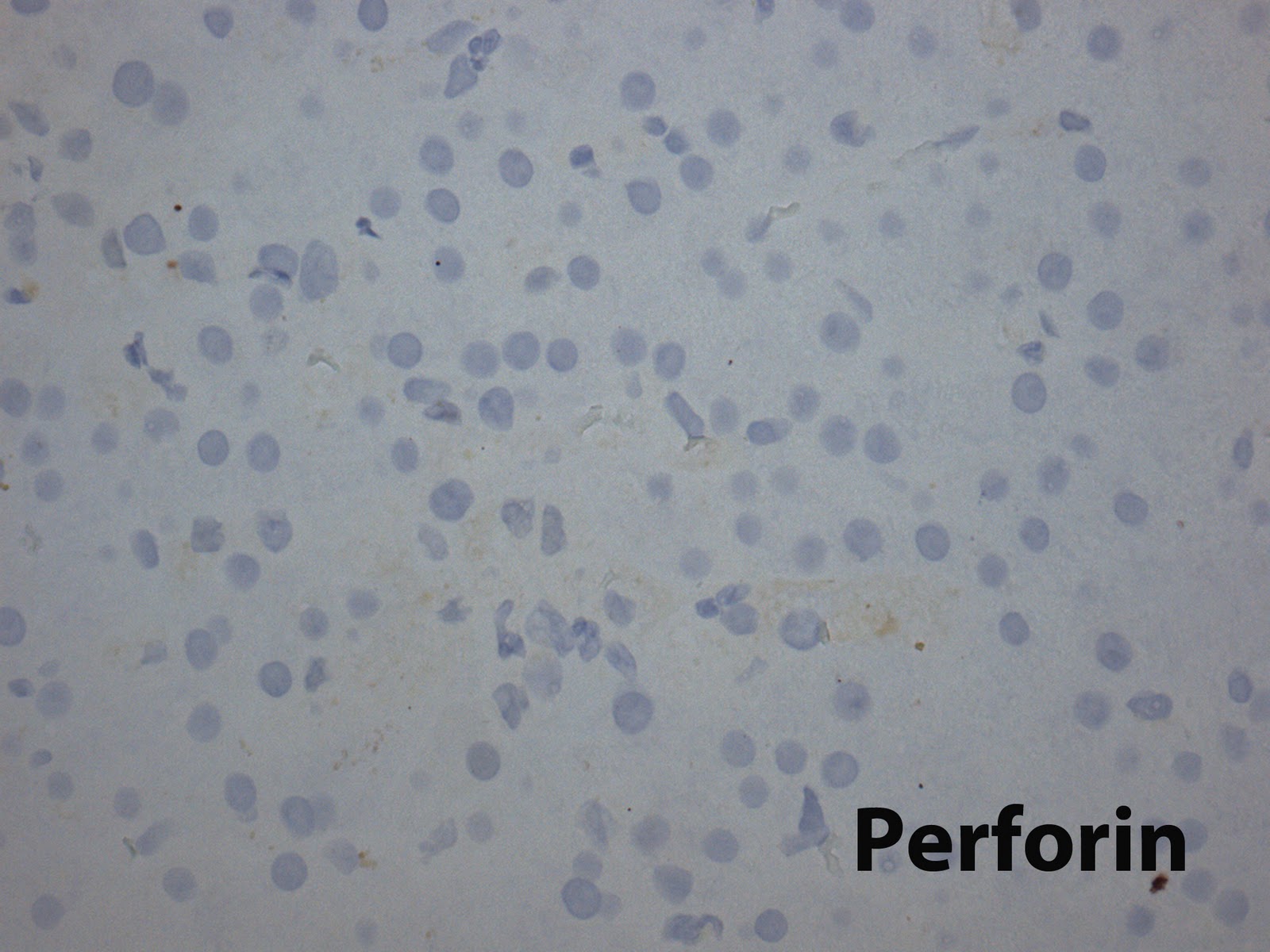 Liver Pathology Update: March 2011