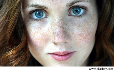 TU SALUD: Como Combatir Las Pecas Y Manchas En La Piel