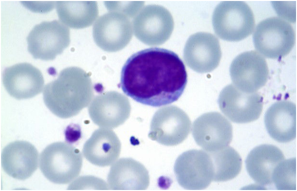 Hematologia Clínica : Atlas de Hematologia