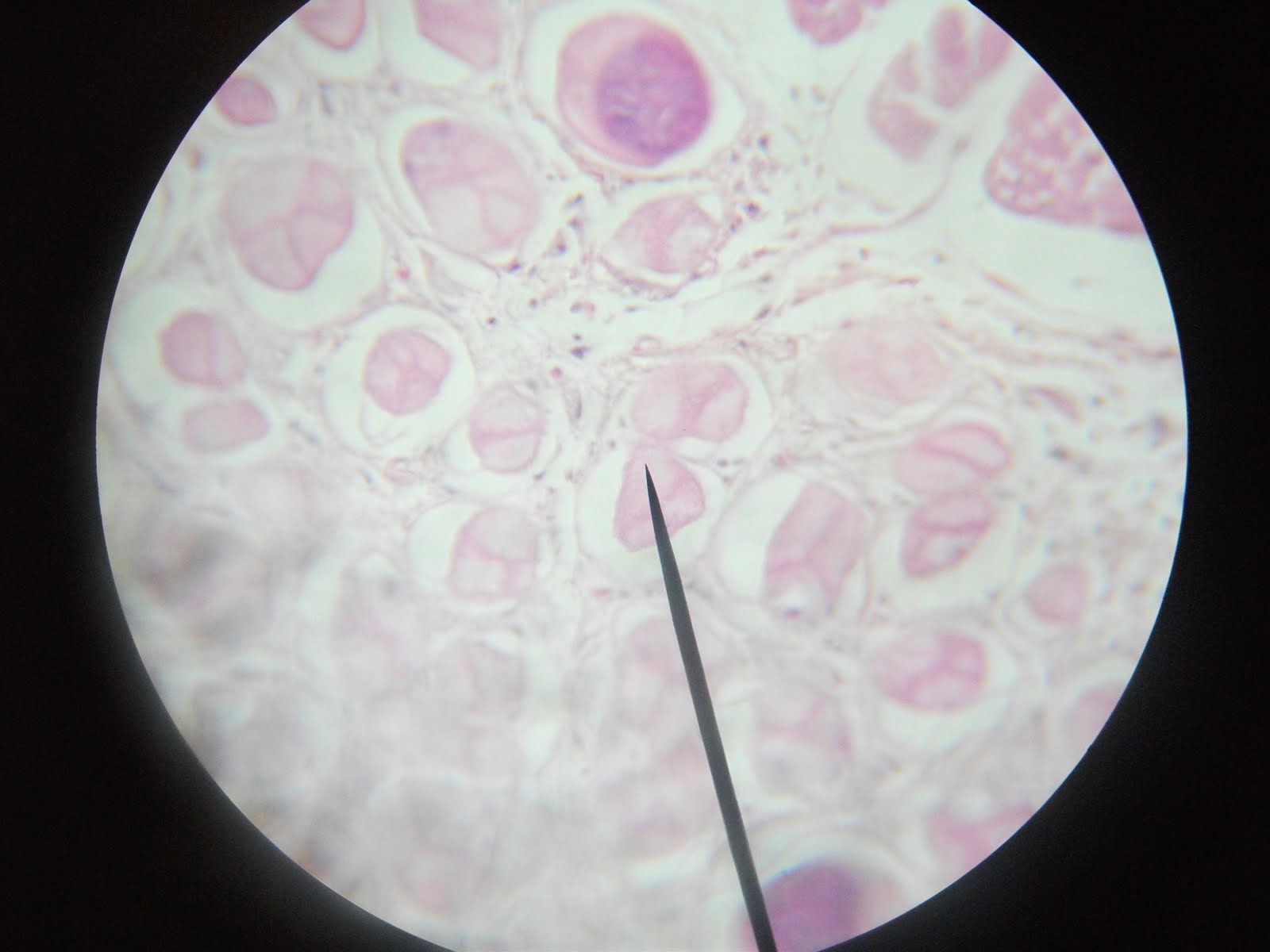 Moderator Band Histology
