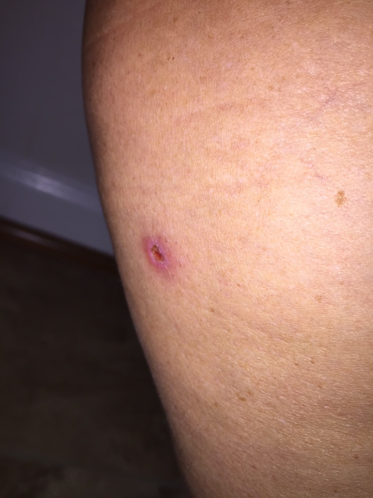 Medical Anomalies Tour 2017