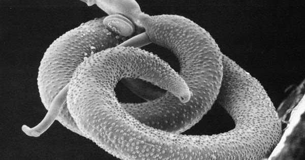 Infection Landscapes: Schistosomiasis