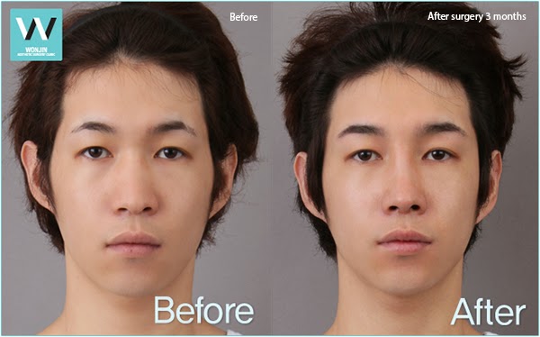 Nose Arrow Arrow Arrow