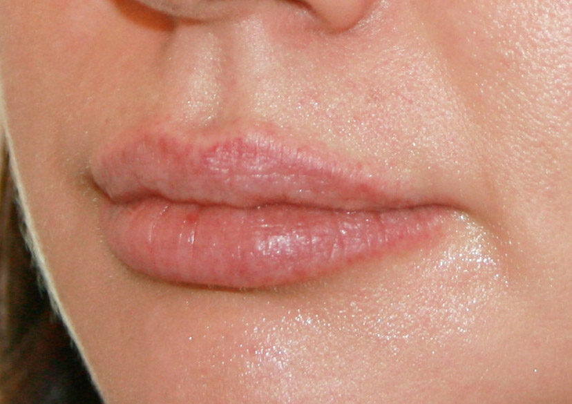 Precision Permanent Cosmetics