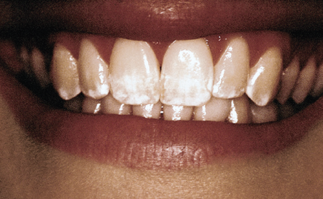 drg. Margaretha Yessi Budiono: Mengapa gigi berubah warna?