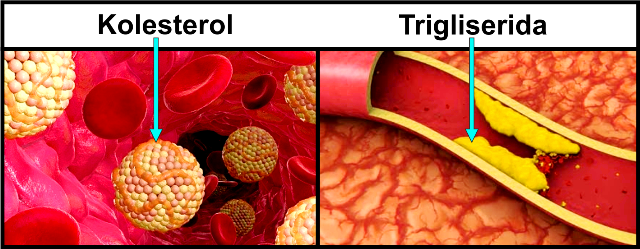 Perbedaan Trigliserida dengan Kolesterol ~ Green World | Deep Sea Fish Oil
