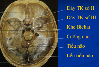 học Y: hội chứng tăng áp lực nội sọ