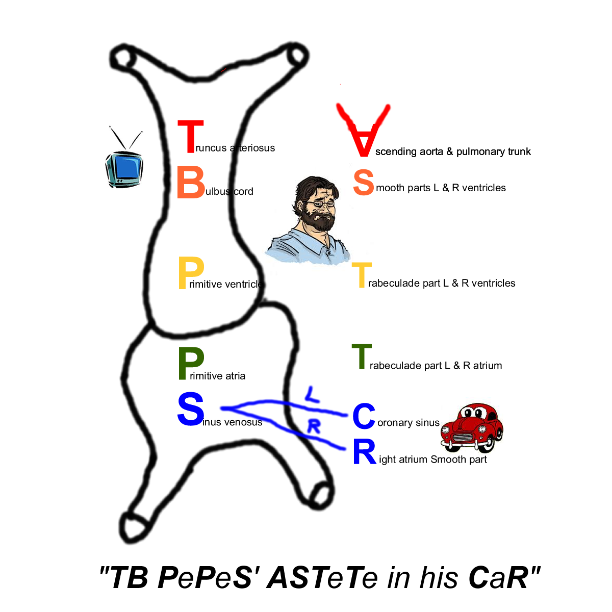 Medical MindMaps for USMLE Step 1: Heart Embryology