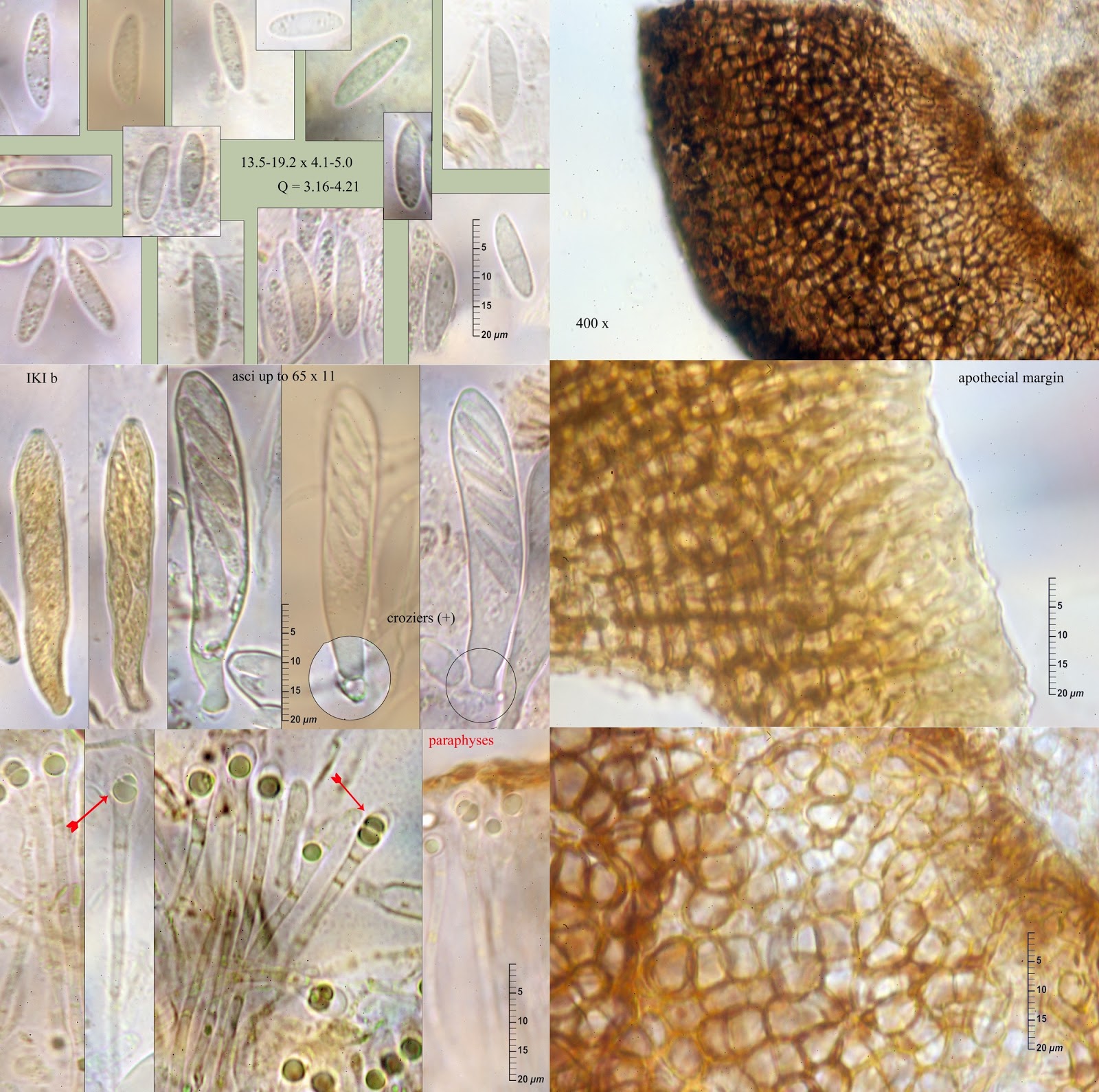 Micropeziza mollisioides (Höhnel) H.-O. Baral, S. Helleman