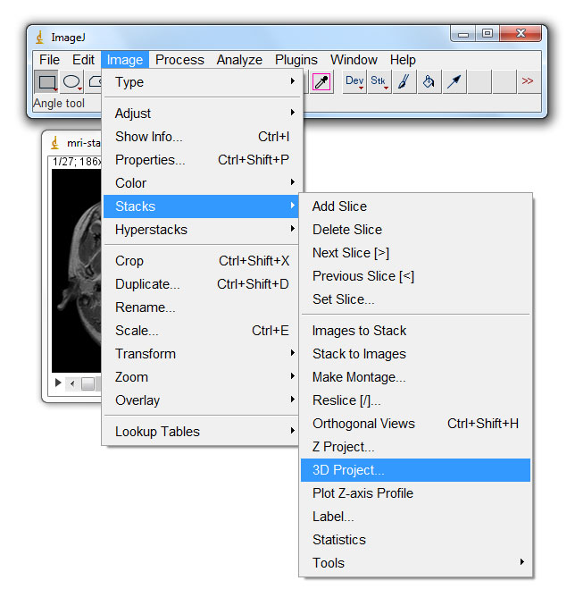 My imageJ: เมนู Image with ImageJ [ตอนที่ 30] Stacks, การแสดงภาพด้วย ...