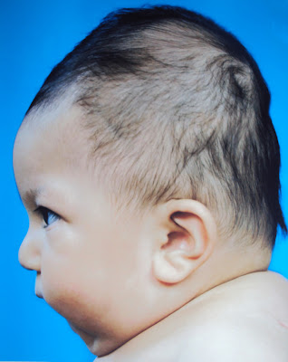 ANESTESIA PEDIATRICA SCARE: abril 2012