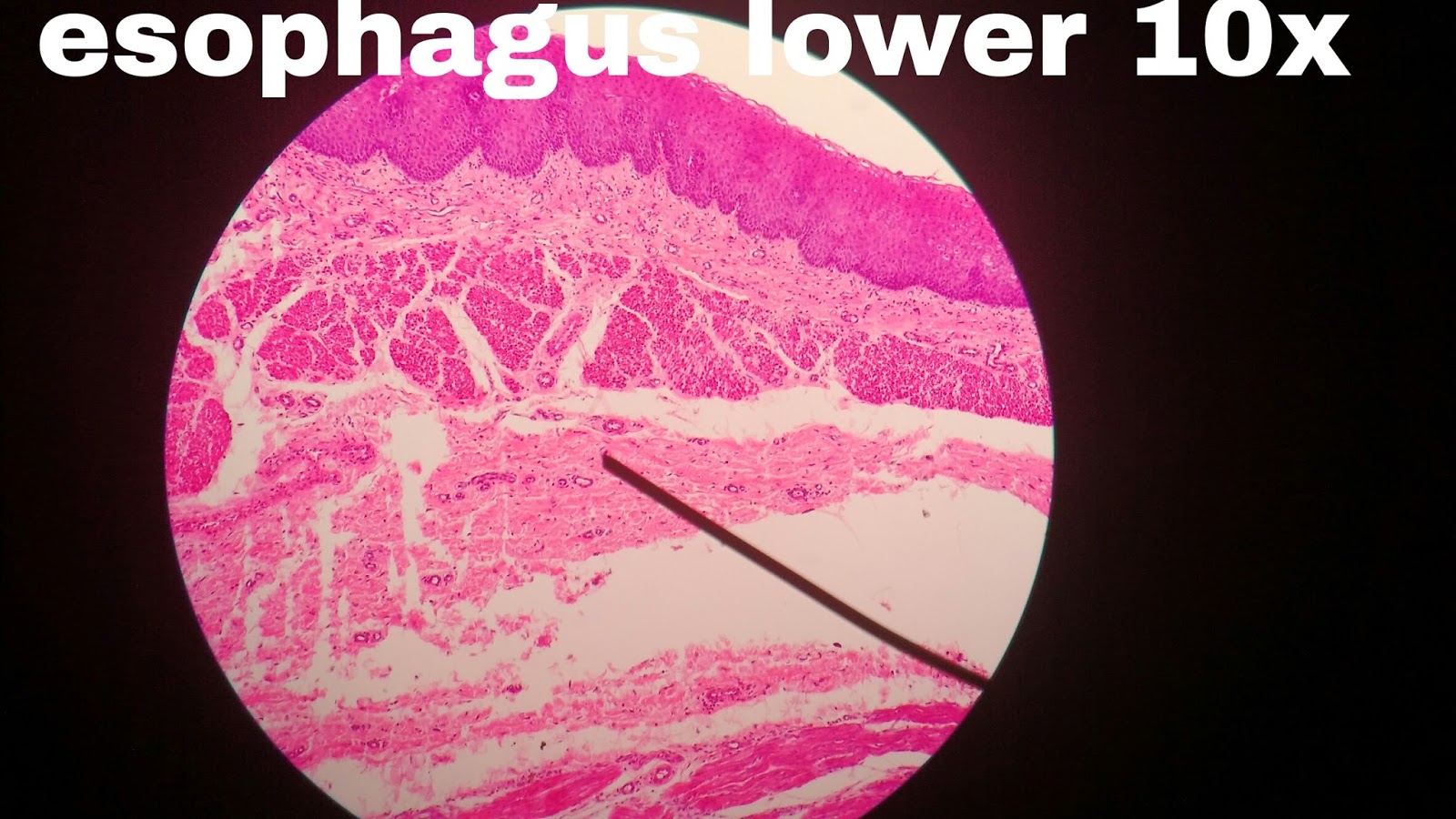 Esophagus Histology