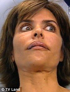 Lisa Rinna Lip Surgery