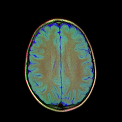 Nevit's blog: Color MRI of the Brain