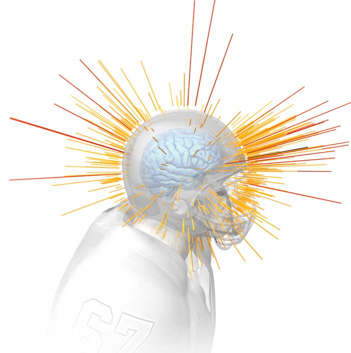 SPACE - THE PREMIER SPORTS INJURY & PHYSIO CLINIC: Is Contact Sport Bad ...