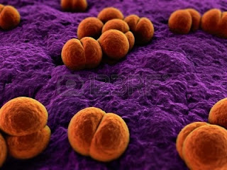 Enfermedades Infectocontagiosas: Meningitis meningococia
