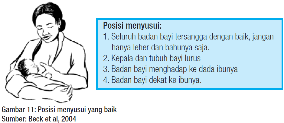 PENYEBAB PUTING SUSU LECET SAAT MENYUSUI | AQILA N A