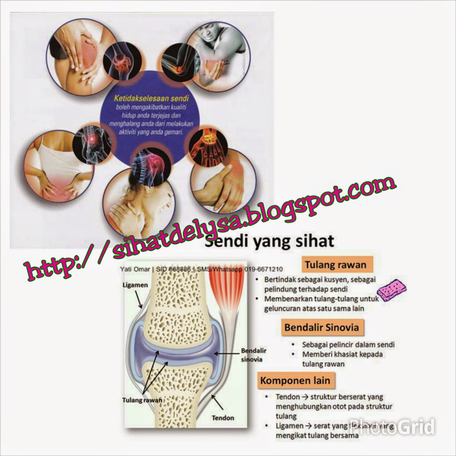 Sihat Delysa 0194269547: SAKIT SENDI MAKAN VITAMIN SHAKLEE