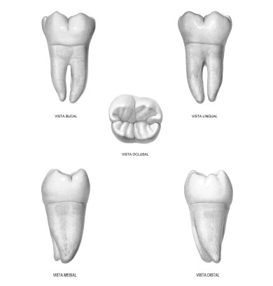 Tutorial Anatomía Cabeza y Cuello: Tercer Molar Inferior.