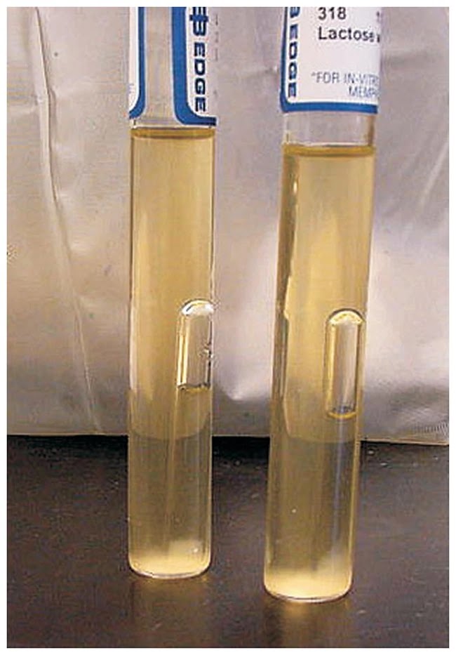 Eijkman Test - Microbiology Laboratory Turkey