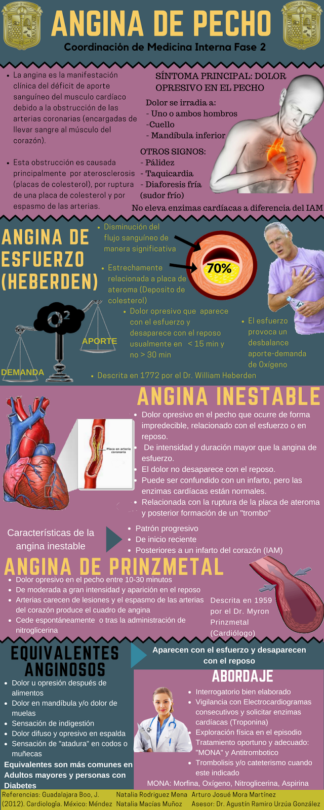 DIVULGACIÓN CIENTÍFICA UG: Angina de Pecho