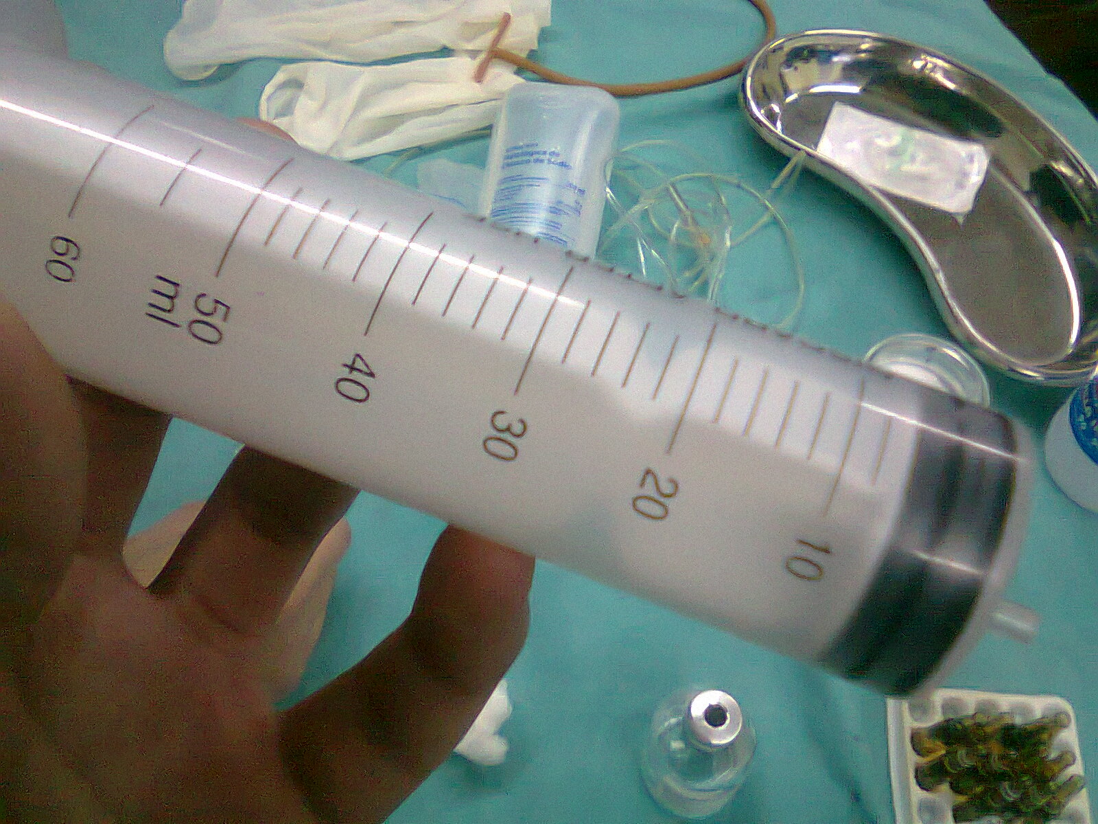 RX- Estudios Contrastados: "Medios de Contraste"