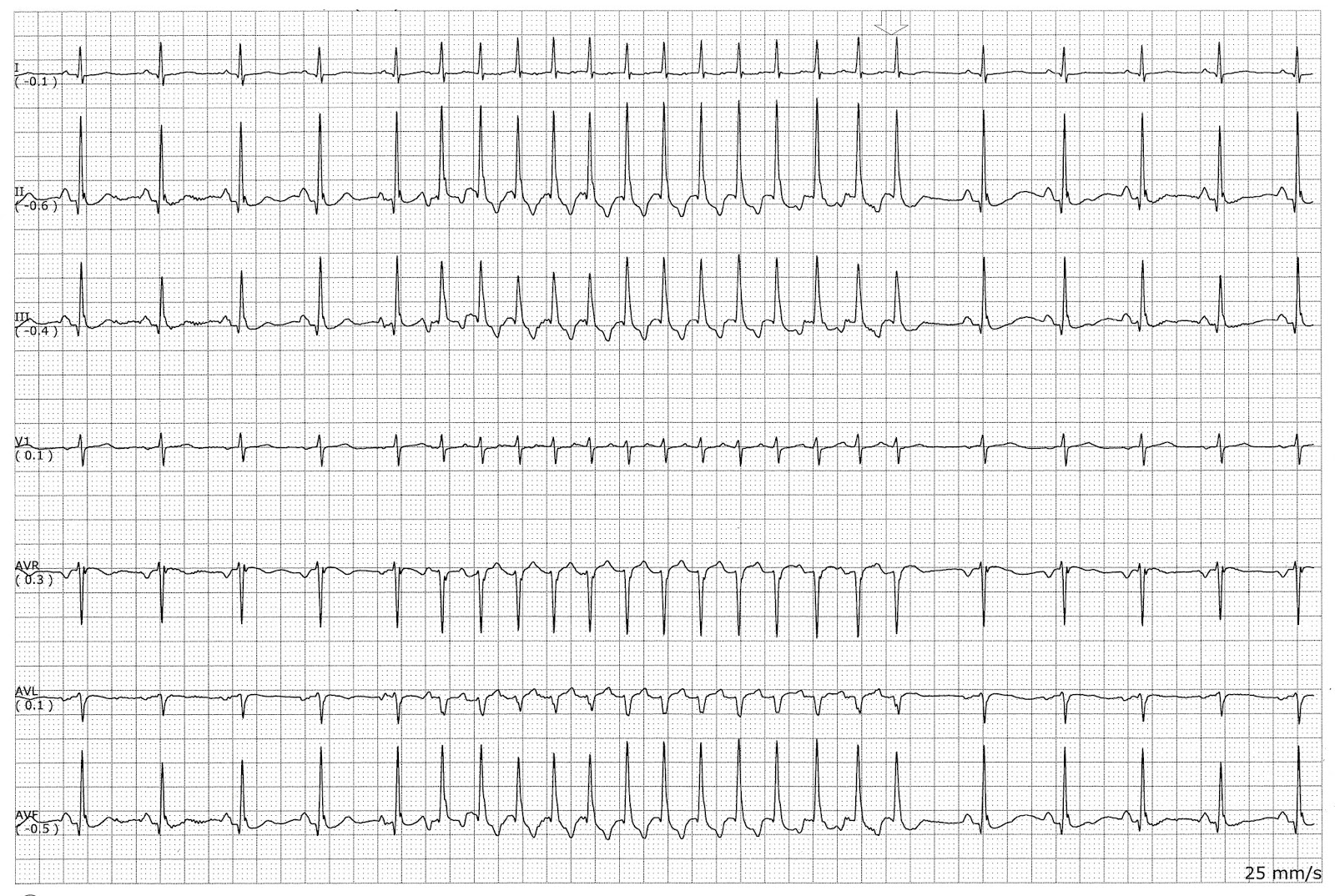 Float Nurse: November 2017