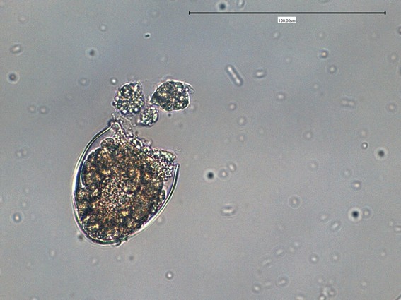 Fun With Microbiology (What's Buggin' You?): Diphyllobothrium latum ...