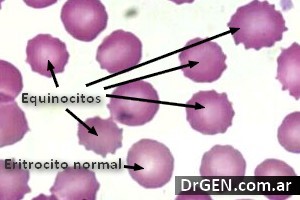 Blog del Laboratorio clinico : 02/19/17