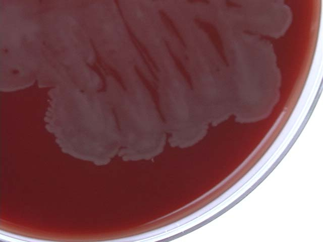 Lecture Notes in Medical Technology: Lecture #11: GRAM NEGATIVE BACILLI ...