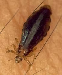 Cara Menghilangkan Kutu Rambut Dengan Cepat | PRO Inspector