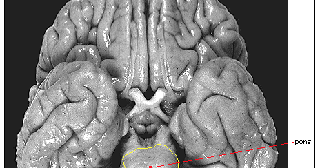 Atlas de neuroanatomía: METENCÉFALO