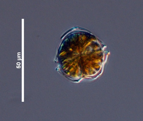 Ilmu Pelita Kehidupan: Eutrofikasi & Plankton