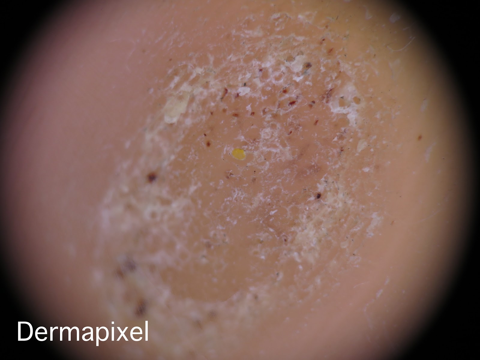 Dermapixel